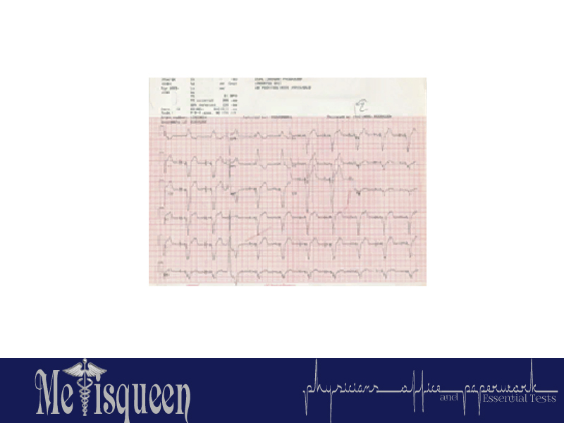 The Sims Resource - Patient EKG