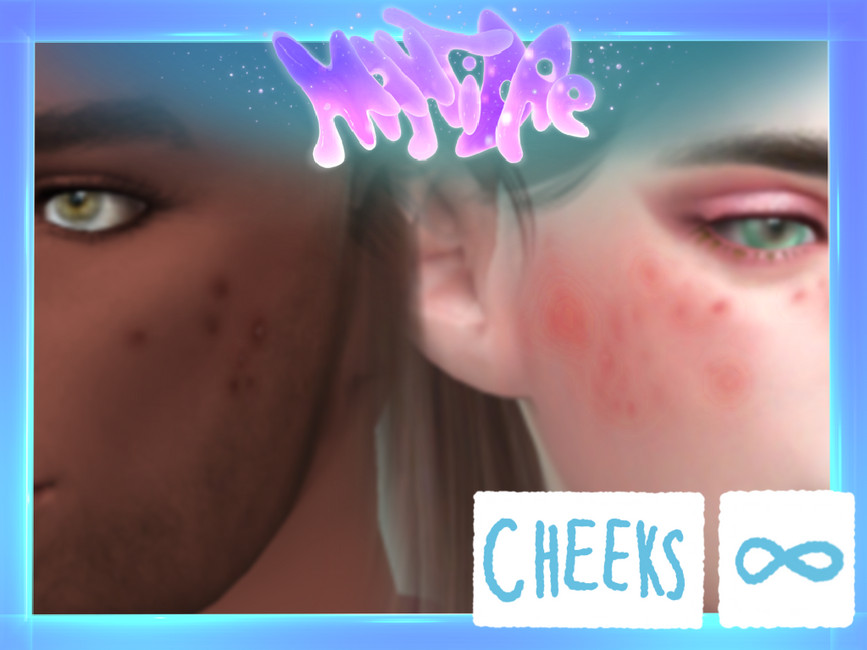 The Sims Resource - Acne Overlays - Cheeks V1