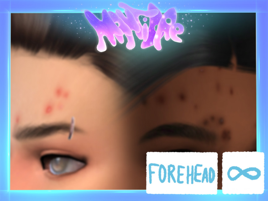 The Sims Resource - Acne Overlays - Forehead V1